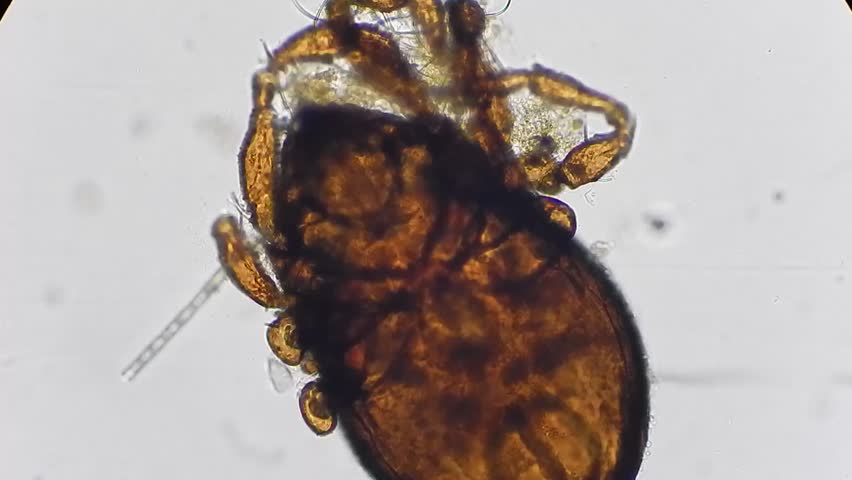 Dead Water Mite Under Microscope 40x Stock Footage Video 11555813 Shutterstock