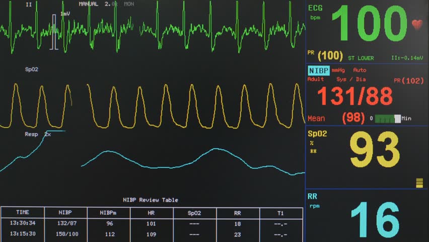 EKG Monitor In ICU Unit Show The Waves Of Blood Pressure, Blood Oxygen ...