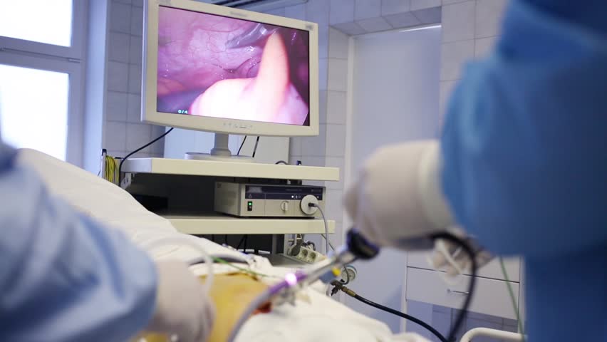 Two Doctors Prepare The Girl To The Endoscopy Stock Footage Video ...