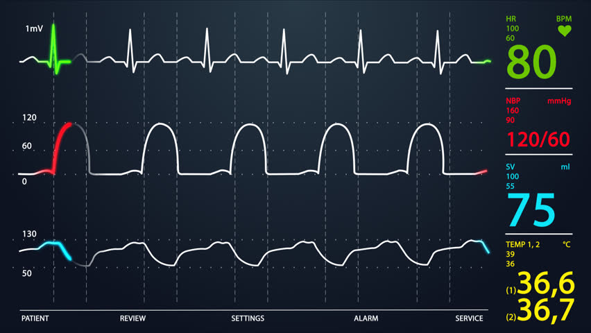 Animation Of Schematic Intensive Care Unit Monitor Showing Normal ...