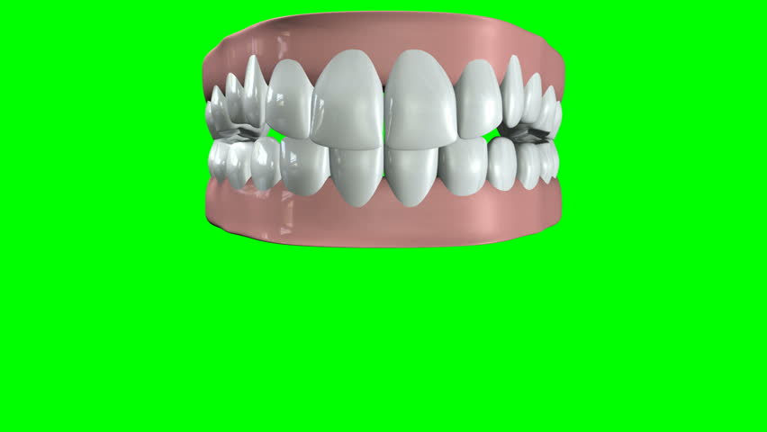 A Closeup Pan Around Of A Set Of Human False Teeth Set In Gums On A ...
