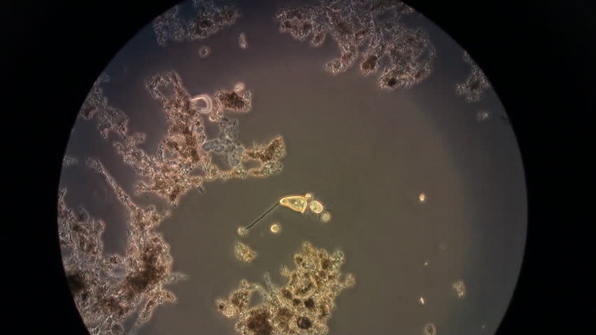 Iron Under Microscope Stock Footage Video 7706170 - Shutterstock