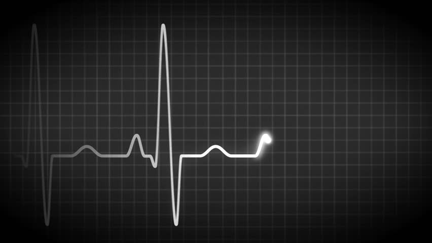 Close Up Of A Looping EKG Display Electrocardiogram Pulse Real Waveform ...